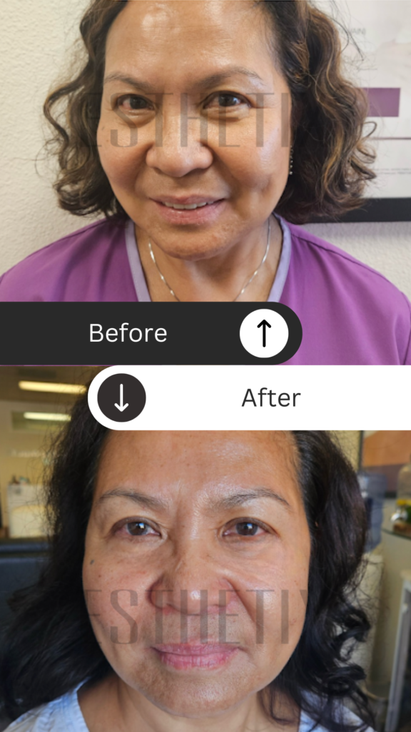 GALLERY - Esthetix Spa